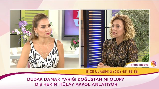 Dudak damak yarığı nedir? | Show TV Sağlık