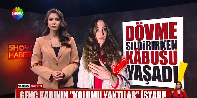 Dövme gitti, yara kaldı! | Show Özel Haber